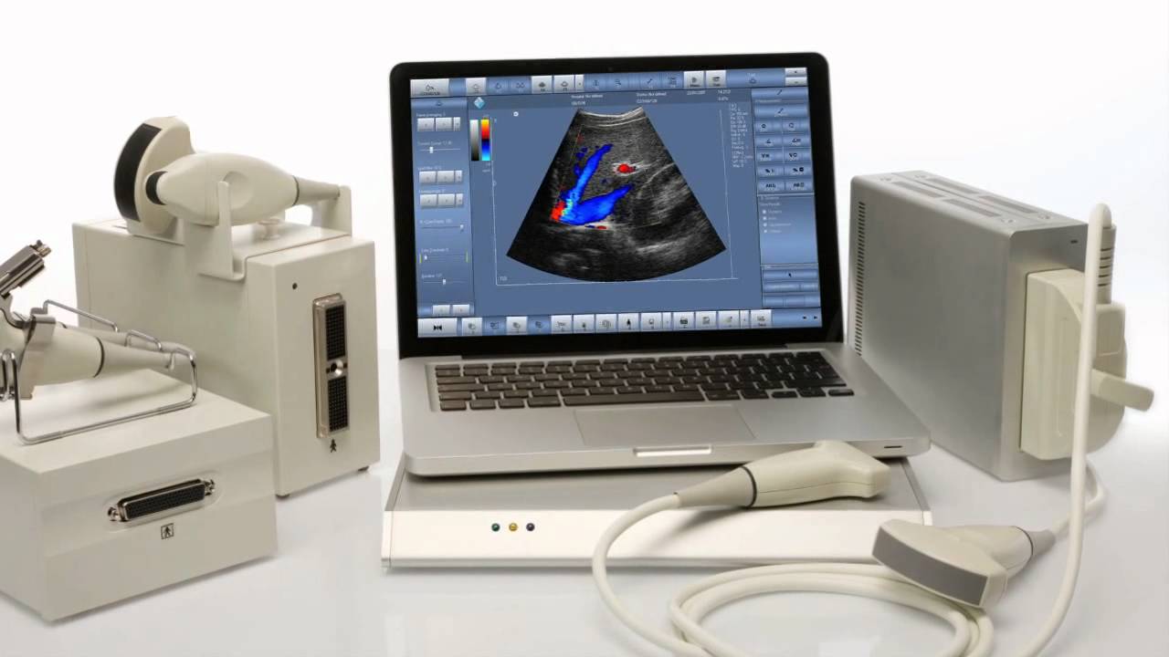 Ecodoppler, esame utile e senza controindicazioni!