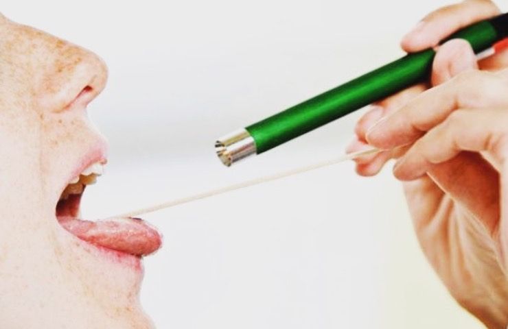 Tumore alla bocca: i sintomi che non dobbiamo sottovalutare