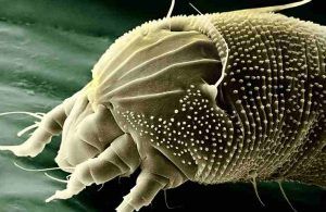 Acari del letto, il consiglio pratico su come eliminarli in modo rapido