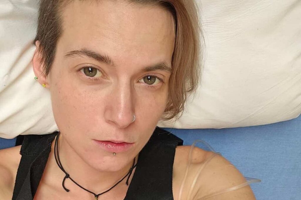 Si chiama "malattia del Vampiro": la diagnosi ad una giovane donna di ...