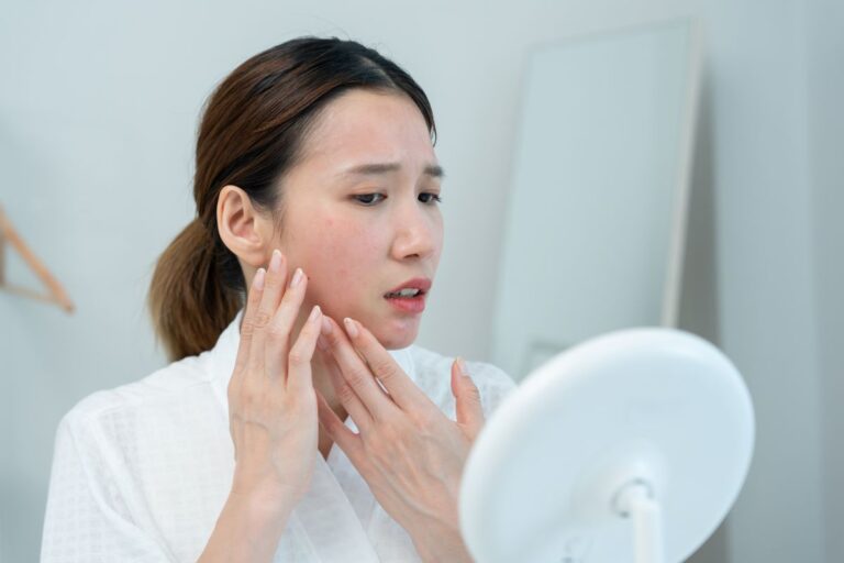 Dermatite viso: come riconoscerla, le tipologie, cause e rimedi